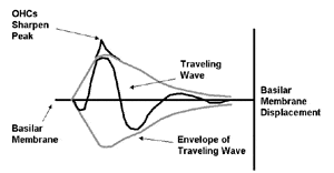 Identifying Cochlear Dead Spots | The Hearing Review