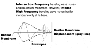 Identifying Cochlear Dead Spots | The Hearing Review