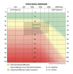 The Color Speech Range Audiogram | The Hearing Review