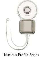 Nucleus Cochlear Implants Now Have Access to MRI