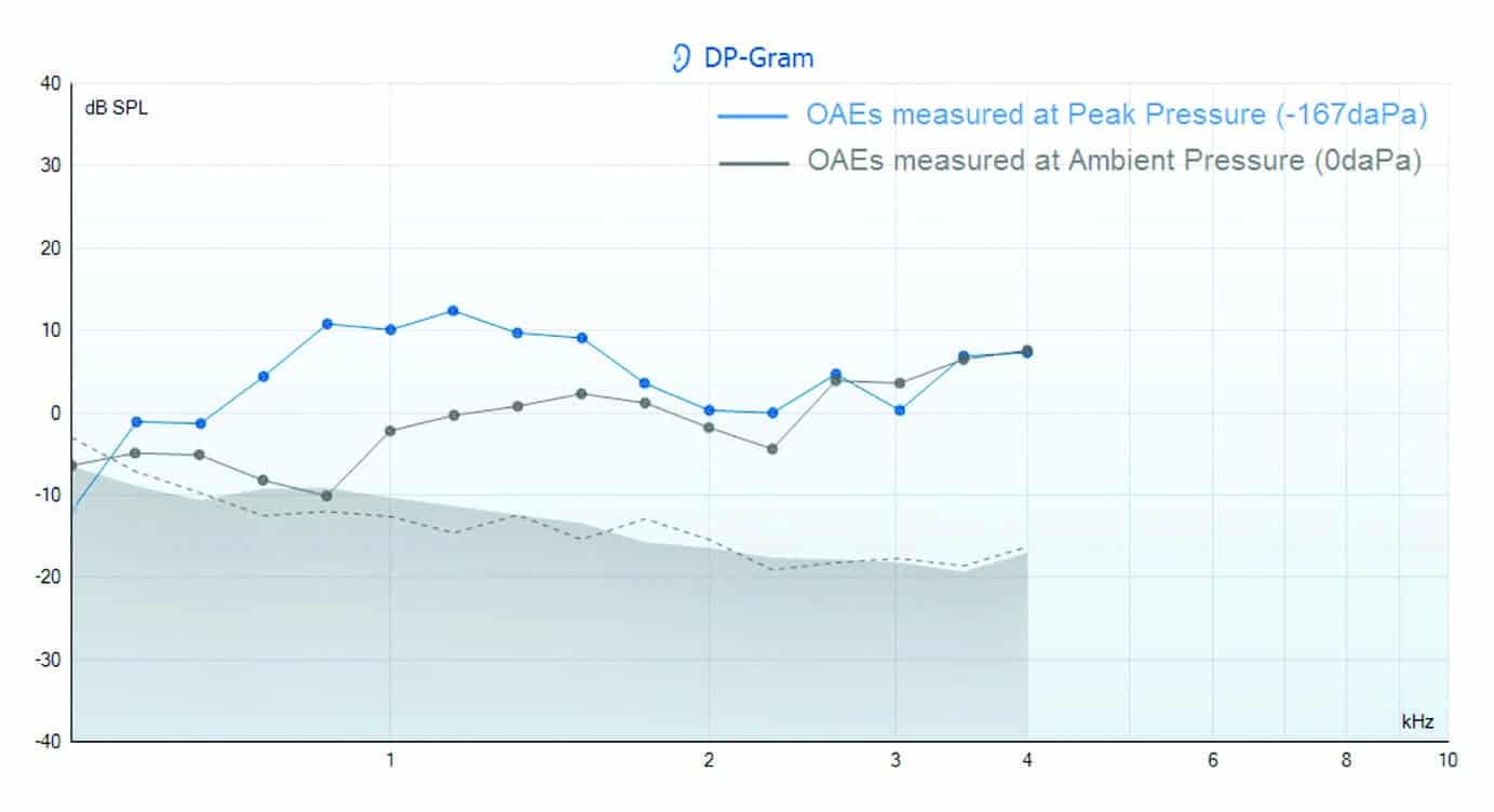 Otoacoustic Emissions and Pressurized OAEs