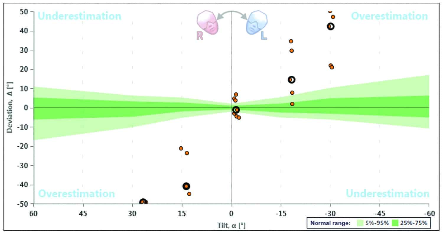 Subjective Visual Vertical (SVV) and the Dizzy Patient | The Hearing Review