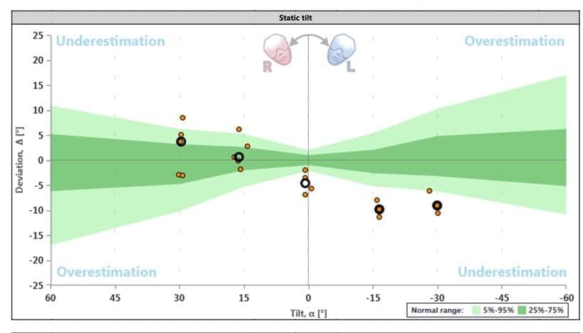 Subjective Visual Vertical (SVV) and the Dizzy Patient - Hearing Review