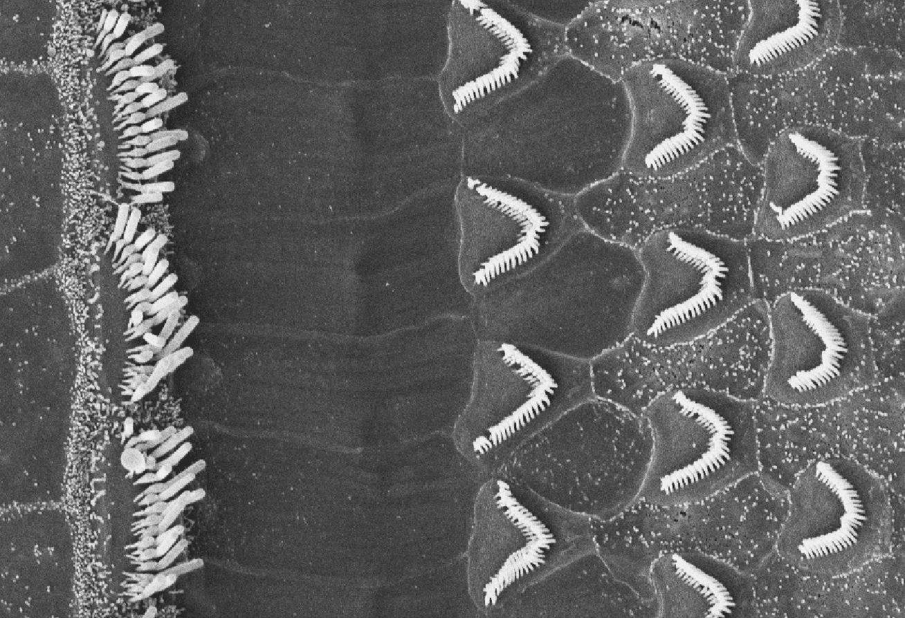 Inner Ear Protein Mechanism for Sound Wave Conversion Identified ...