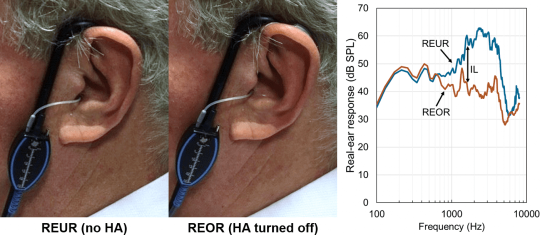 Challenges of Instant-Fit Ear Tips: What Happens at the Eardrum? | The ...
