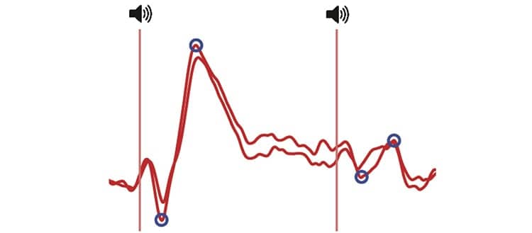 Researchers Study Mechanism behind Auditory Sensory Gating | The ...