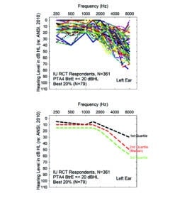 What Is Normal Hearing | The Hearing Review
